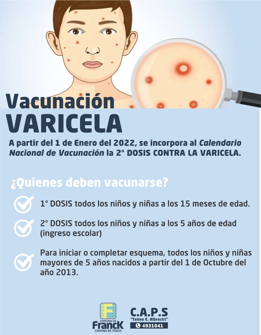 Se Incorpora Segunda Dosis Contra La Varicela Al Calendario Nacional